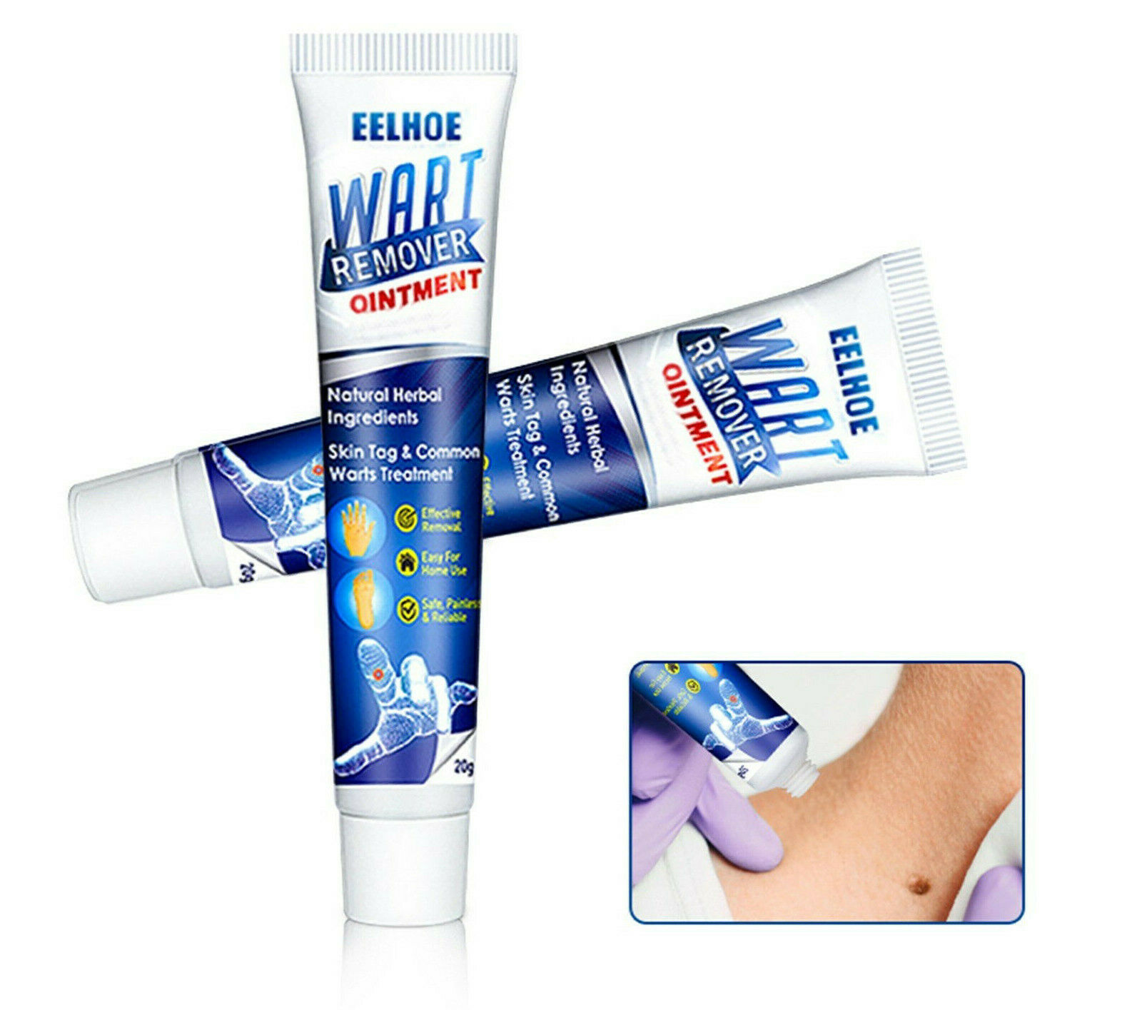 Wart Removal Treatment Cream Plantar Flat Filiform Periungual Common ...